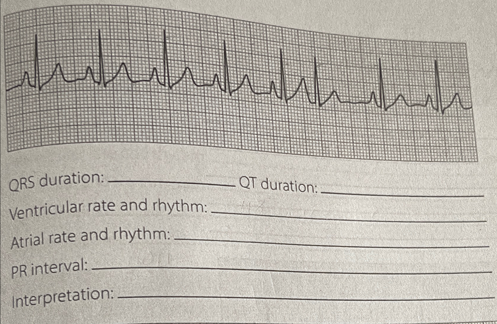 Solved QRS duration:QT duration:Ventricular rate and | Chegg.com