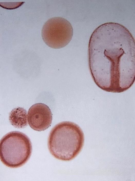 Solved Find the following stages of development on the | Chegg.com
