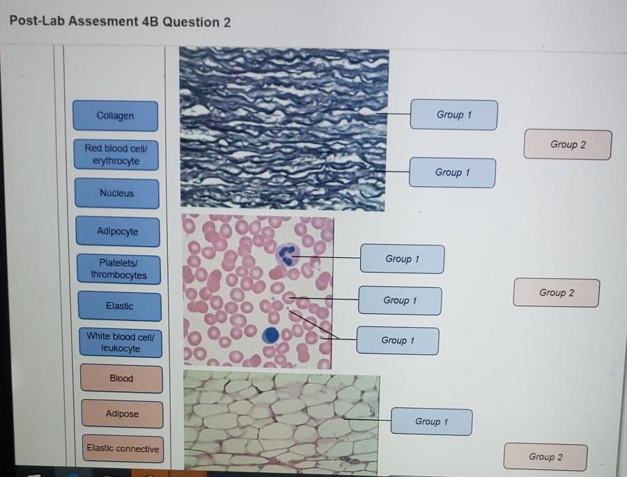 Solved Post-Lab Assesment 4B Question 2 Collagen Group 1 | Chegg.com