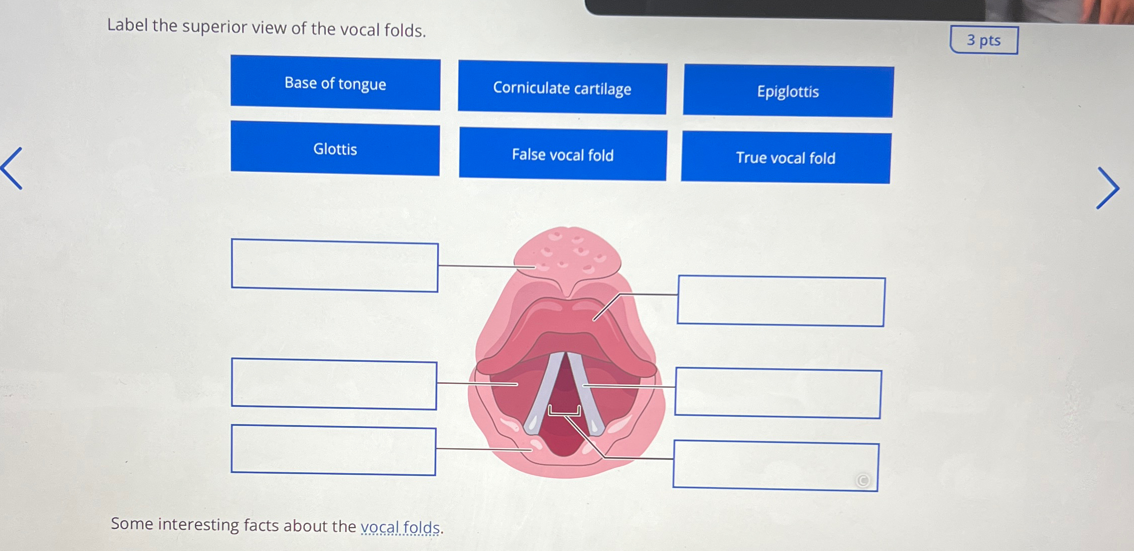 Solved Label the superior view of the vocal folds.Base of | Chegg.com