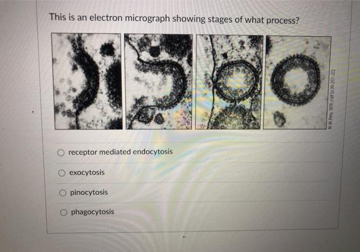 Receptor Mediated Endocytosis Micrograph