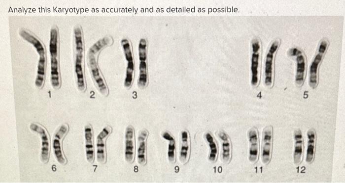 Solved Analyze this Karyotype as accurately and as detailed | Chegg.com