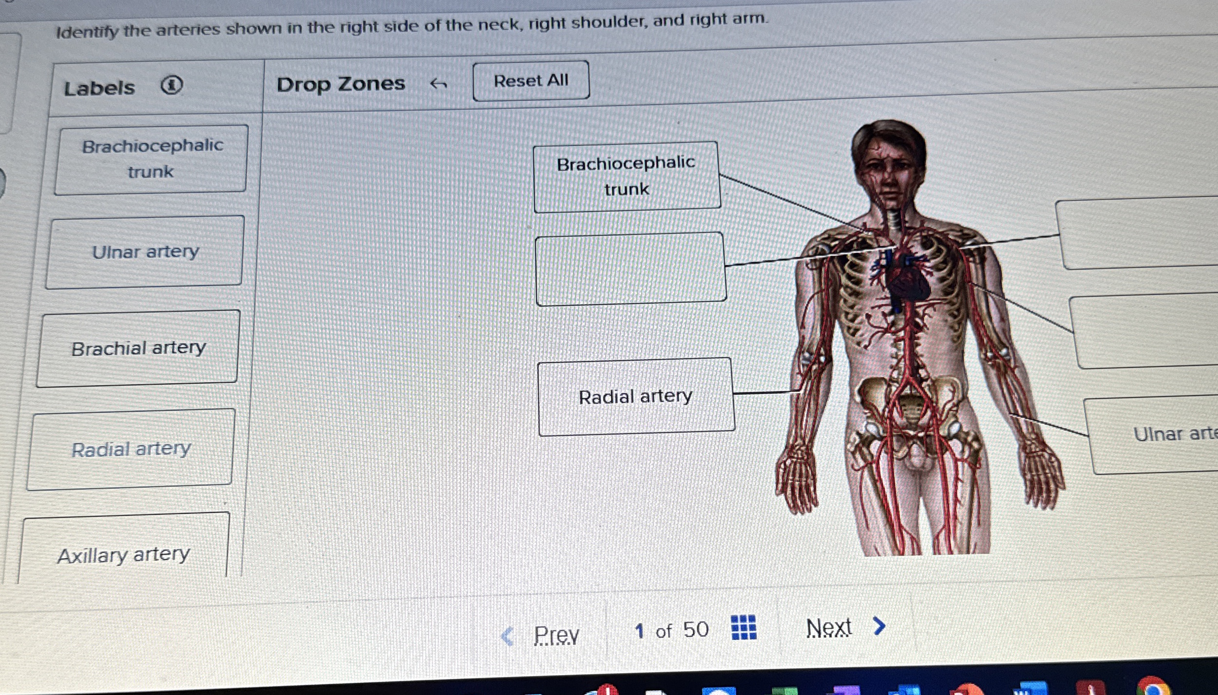 Solved Identify the arteries shown in the right side of the | Chegg.com