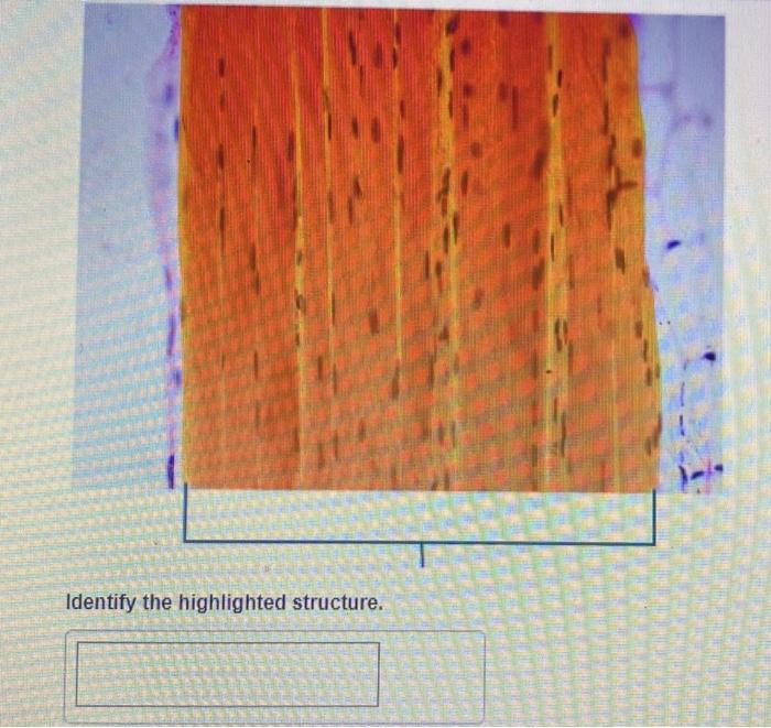 Solved 1 Identify the highlighted structure. | Chegg.com