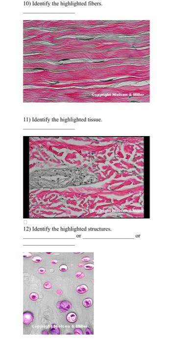 Solved 10) Identify the highlighted fibers. 11) Identify the | Chegg.com
