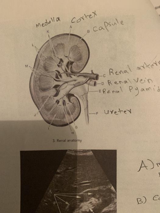 Solved Medulla Cortex • capsule M Renal arter С Renal vein | Chegg.com