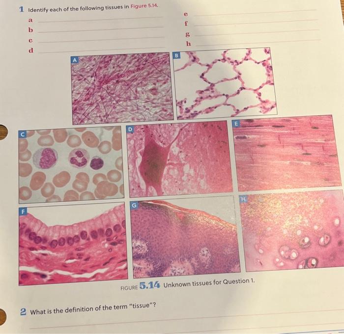 Solved 1 Identify each of the following tissues in Figure | Chegg.com Solved 1 Identify each of the following tissues in Figure | Chegg.com