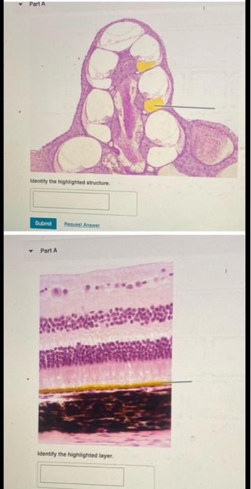 .. Which structure is highlighted? bipolar cell layer | Chegg.com