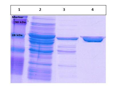 Solved GFP of 27 kDa was expressed in E.coli BL21 pLysE | Chegg.com