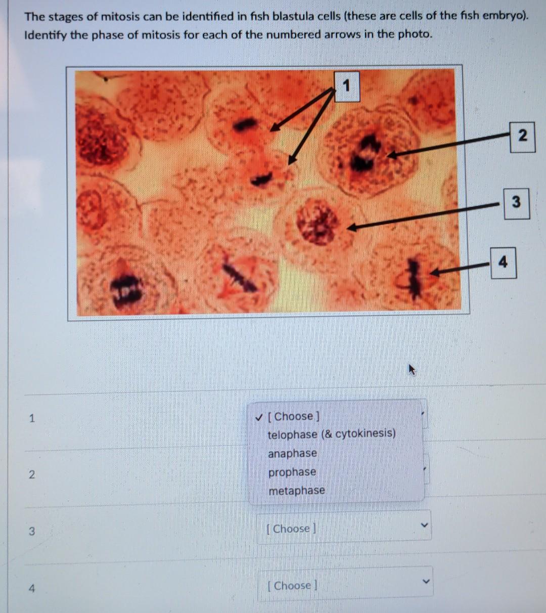 Solved The stages of mitosis can be identified in fish | Chegg.com