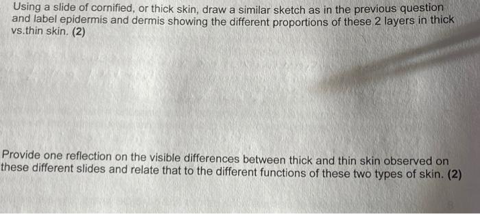 Solved Using a slide of cornified, or thick skin, draw a | Chegg.com