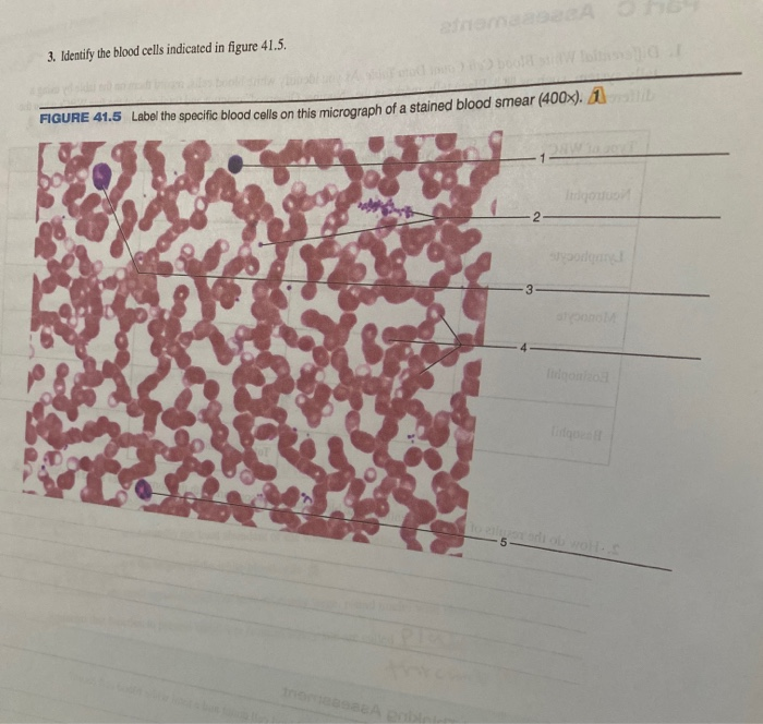 Solved dhamaah 3. Identify the blood cells indicated in | Chegg.com