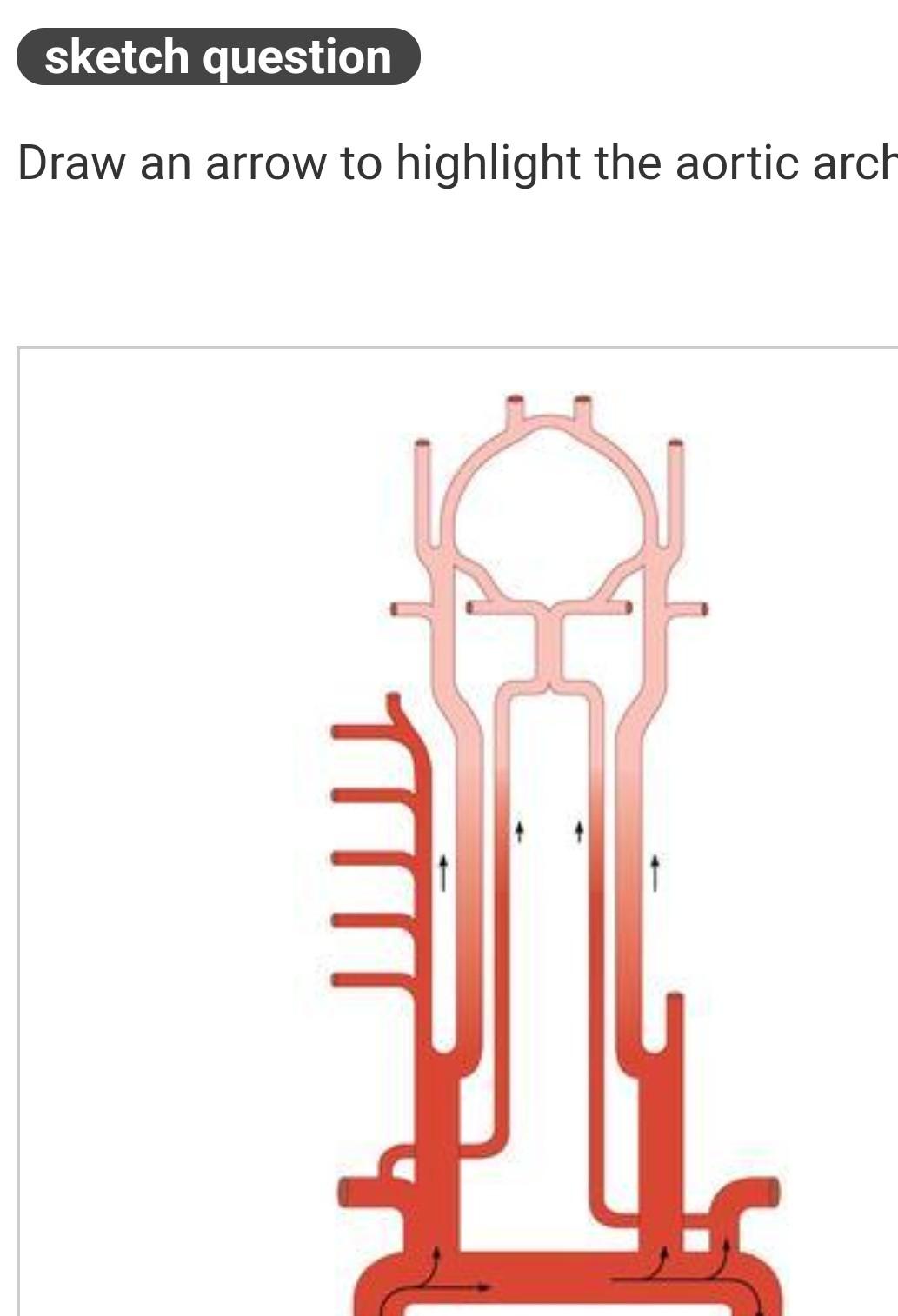 Solved Draw an arrow to highlight the aortic arch | Chegg.com