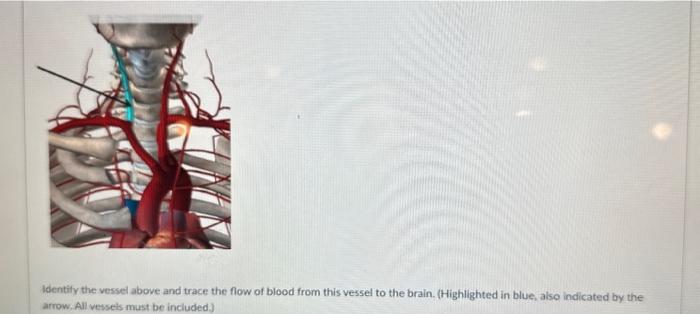 Solved Identity the vessel above and trace the flow of bloed | Chegg.com