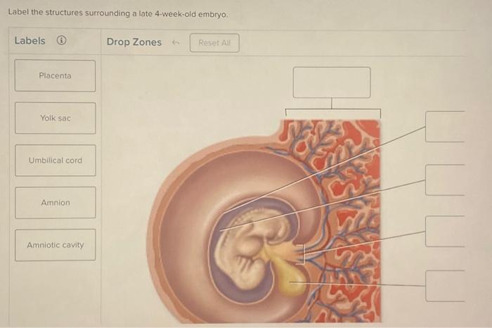 Solved Label the structures surrounding a late 4-week-old | Chegg.com