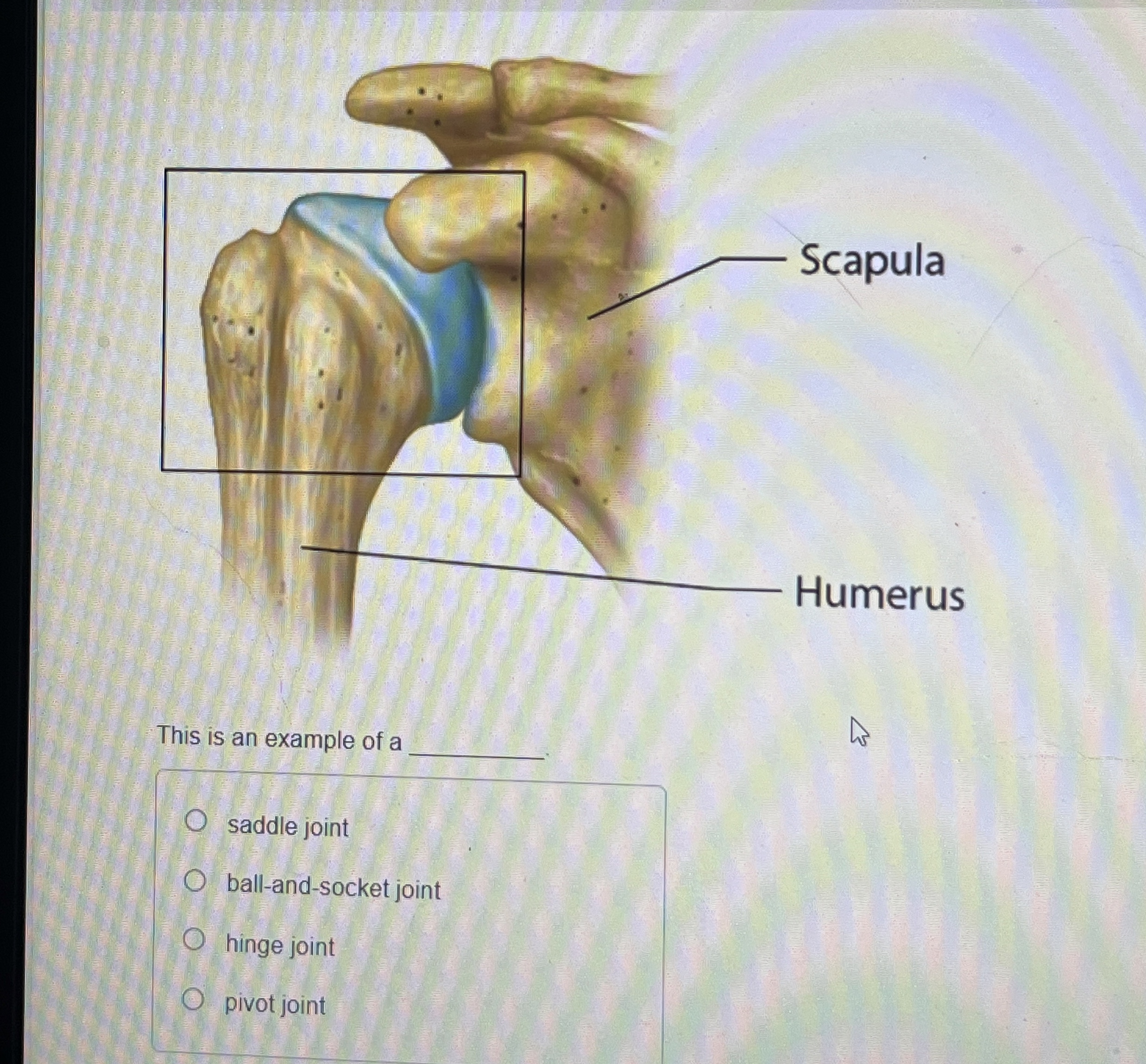 Solved This is an example of a q,saddle jointball-and-socket | Chegg.com