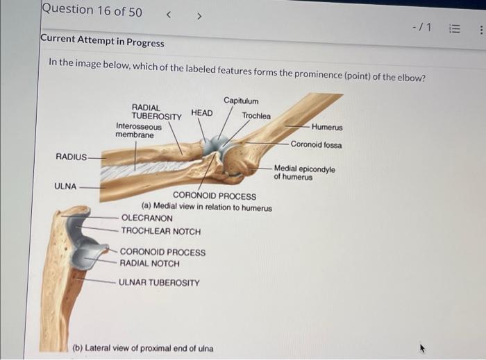 Solved In the image below, which of the labeled features | Chegg.com