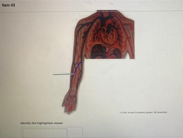 Solved E B F G D H Identify the blood vessel labeled G. 2 | Chegg.com