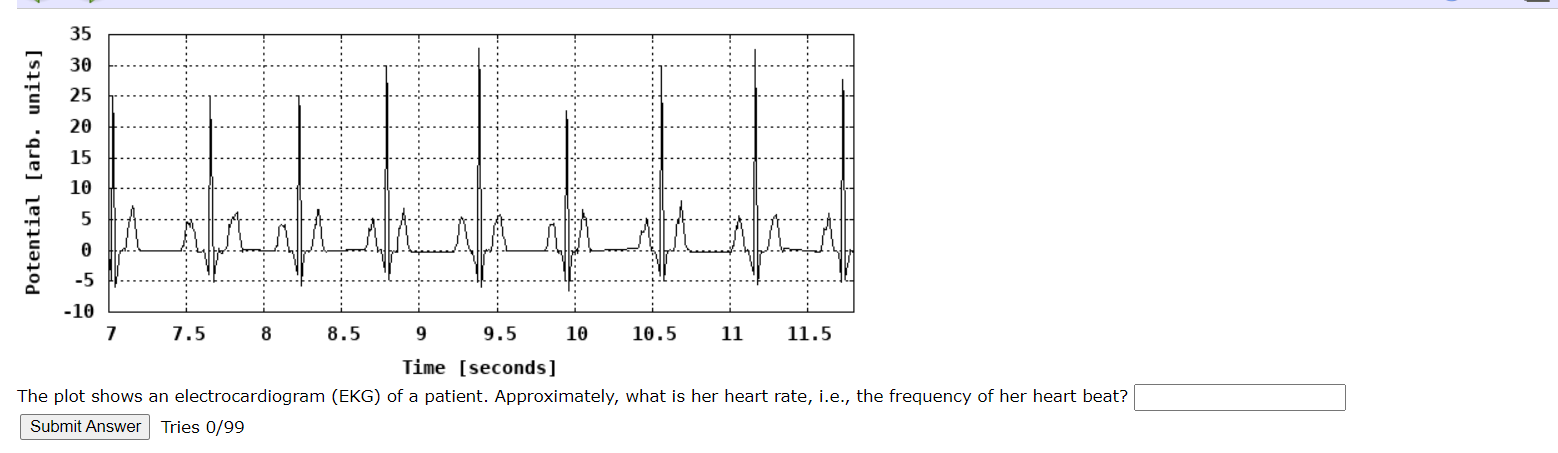 Solved The plot shows an electrocardiogram (EKG) ﻿of a | Chegg.com