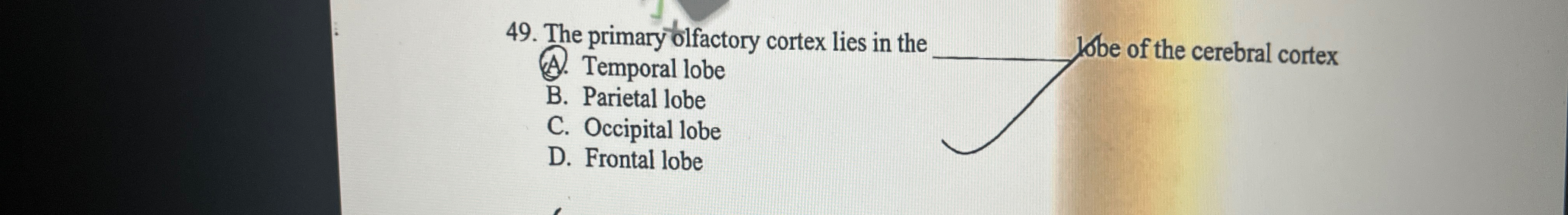 Solved The primary olfactory cortex lies in the (A). | Chegg.com
