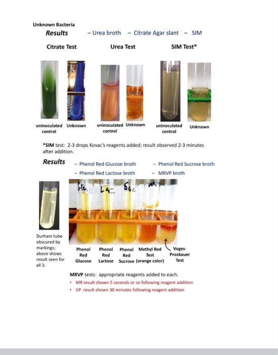 Solved Unknown Bacteria Results Citrate Test - Urea broth - | Chegg.com