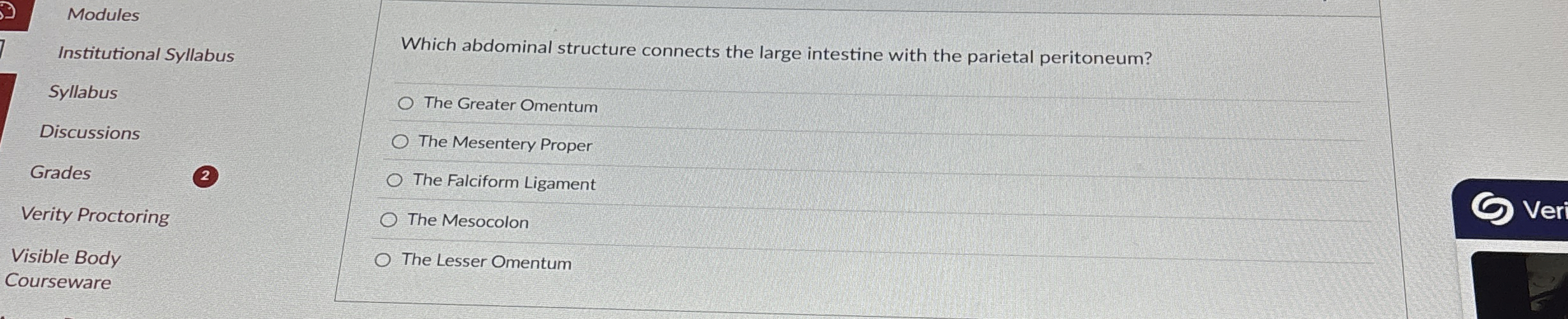 Solved Which abdominal structure connects the large | Chegg.com
