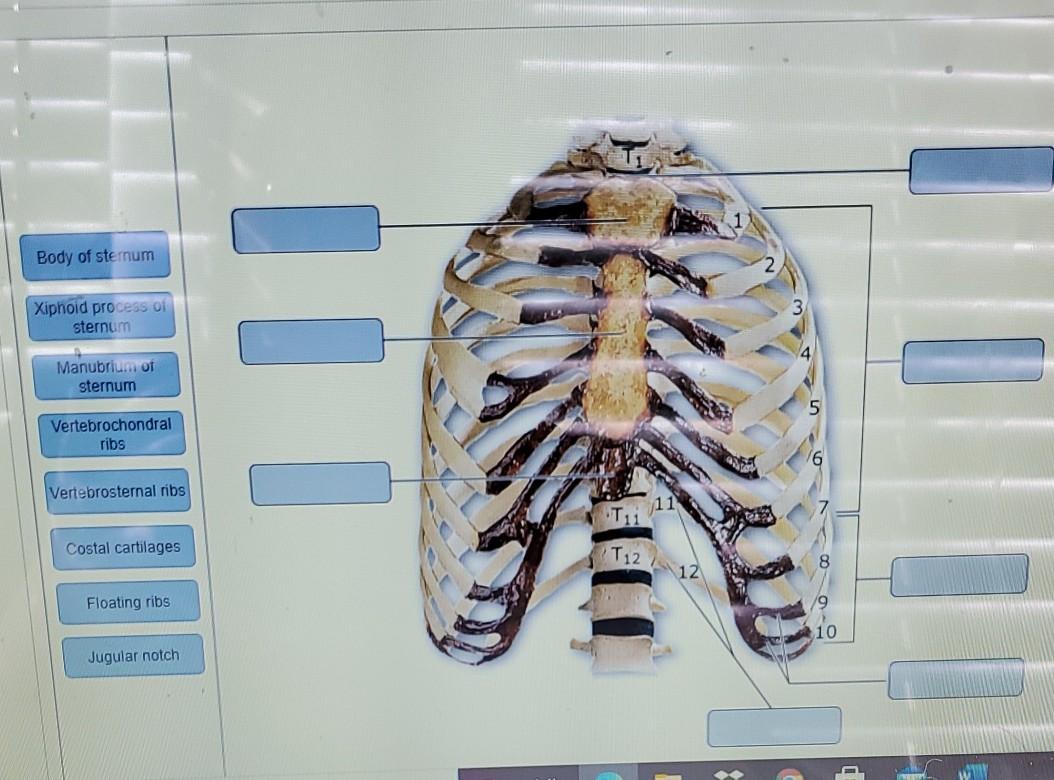 Solved Body of sternum Xiphoid process of sternum Manubrium | Chegg.com