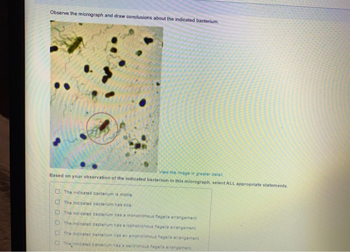 Solved Observe the micrograph and draw conclusions about the | Chegg.com