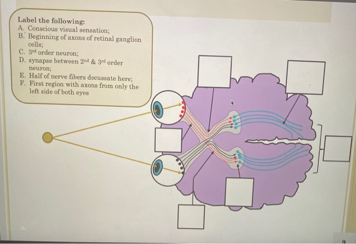 Solved Label the following: A. Conscious visual sensation; | Chegg.com