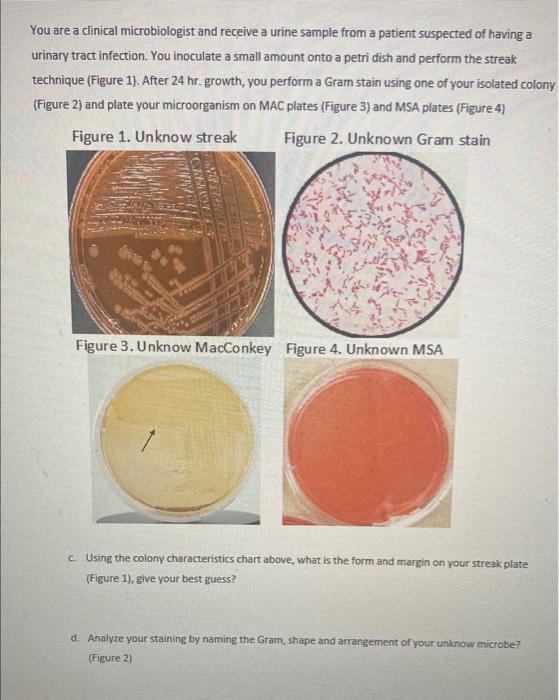 Solved You are a clinical microbiologist and receive a urine | Chegg.com