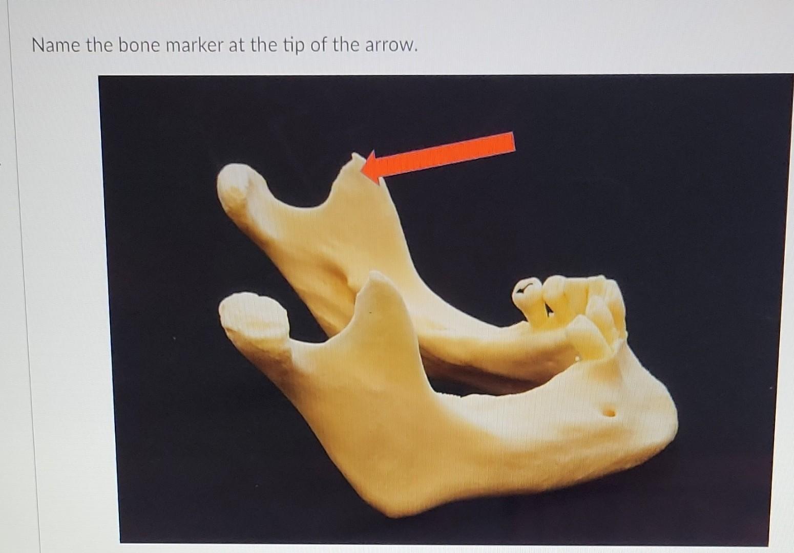 Solved Name the bone marker at the tip of the arrow. Name | Chegg.com