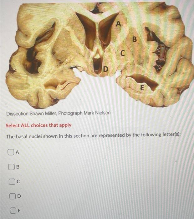 Solved A B C D E Dissection Shawn Miller, Photograph Mark | Chegg.com