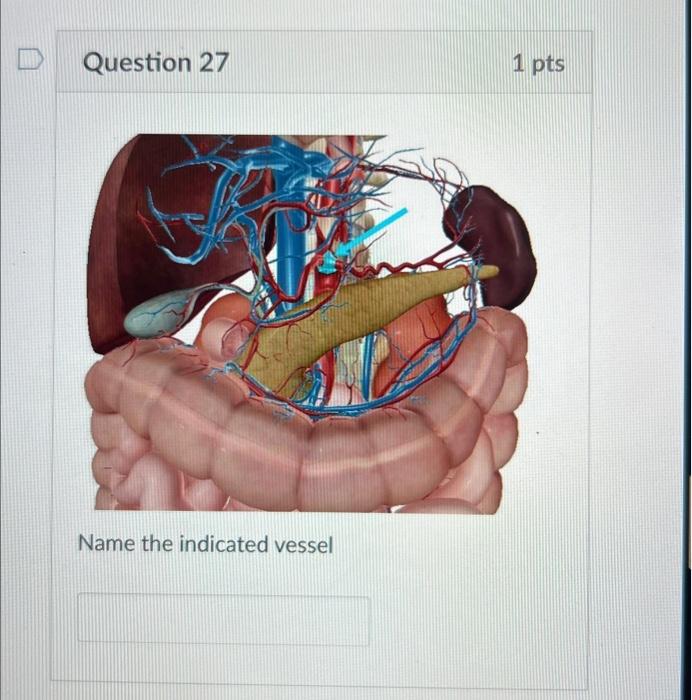 Solved Question 27 Name the indicated vessel Name the | Chegg.com