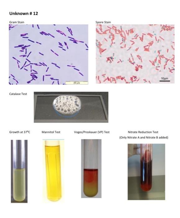 Solved Unknown #12 Gram Stain Spore Stain 10um Catalase Test | Chegg.com