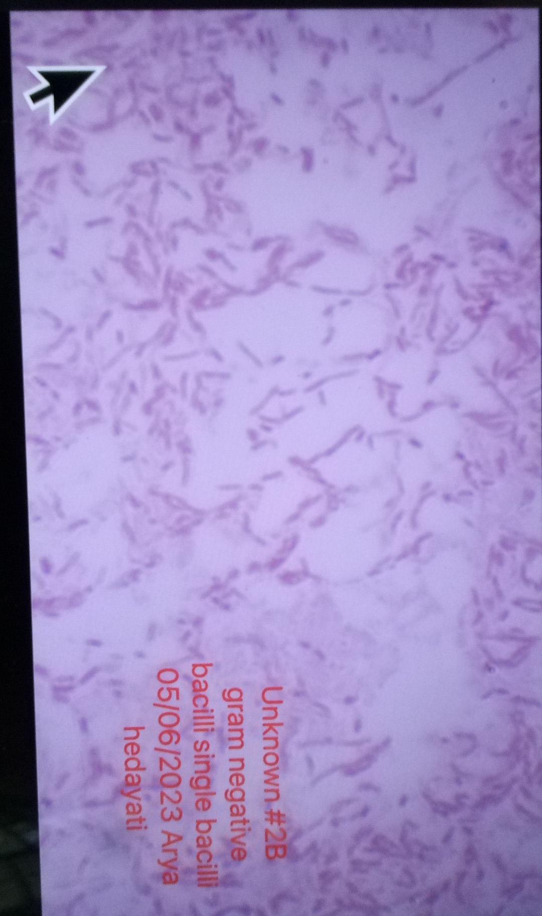 Solved Unknown \#2B gram negative bacilli single bacilli | Chegg.com