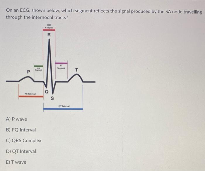 Solved On an ECG, shown below, which segment reflects the | Chegg.com