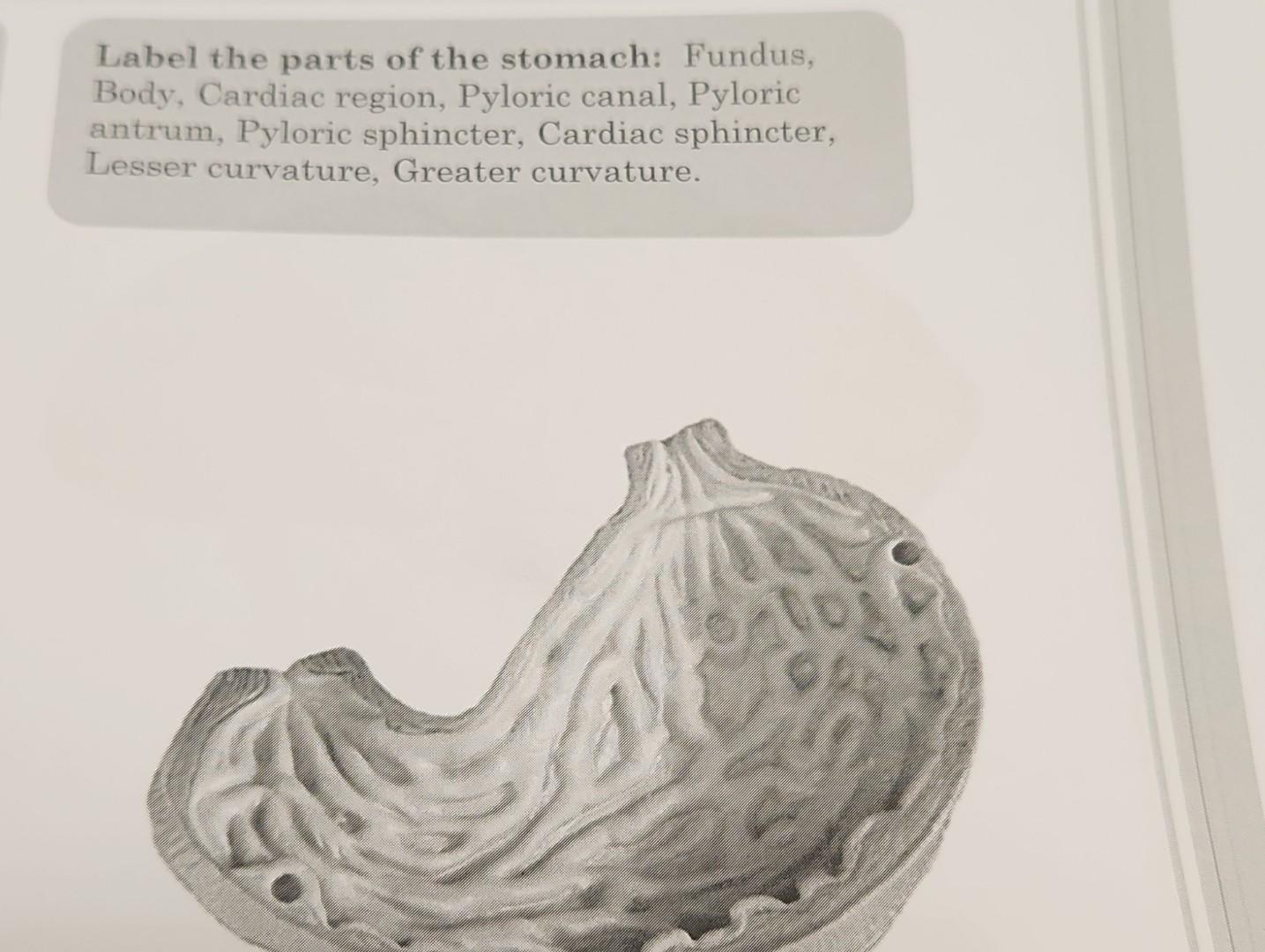 Solved Label the parts of the stomach: Fundus, Body, Cardiac | Chegg.com