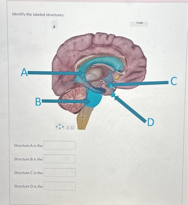 Solved Identify the labeled structures: A B- Structure A is | Chegg.com