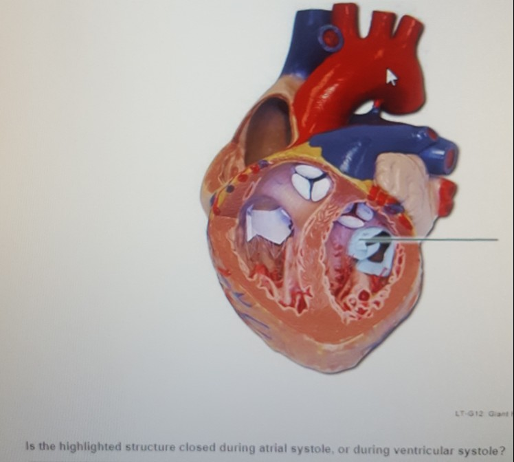 Solved 1-G92: Giant Identify the highlighted structures. | Chegg.com