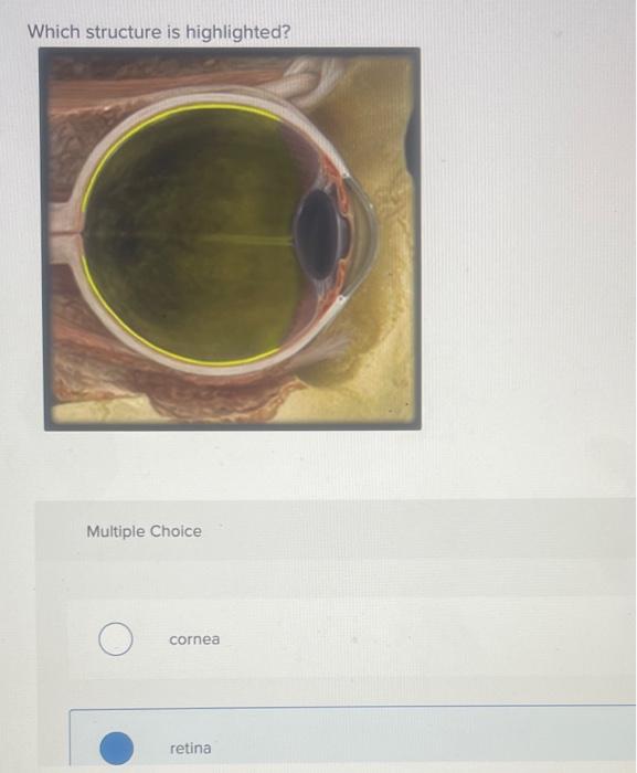 Solved Which structure is highlighted? Multiple Choice O | Chegg.com