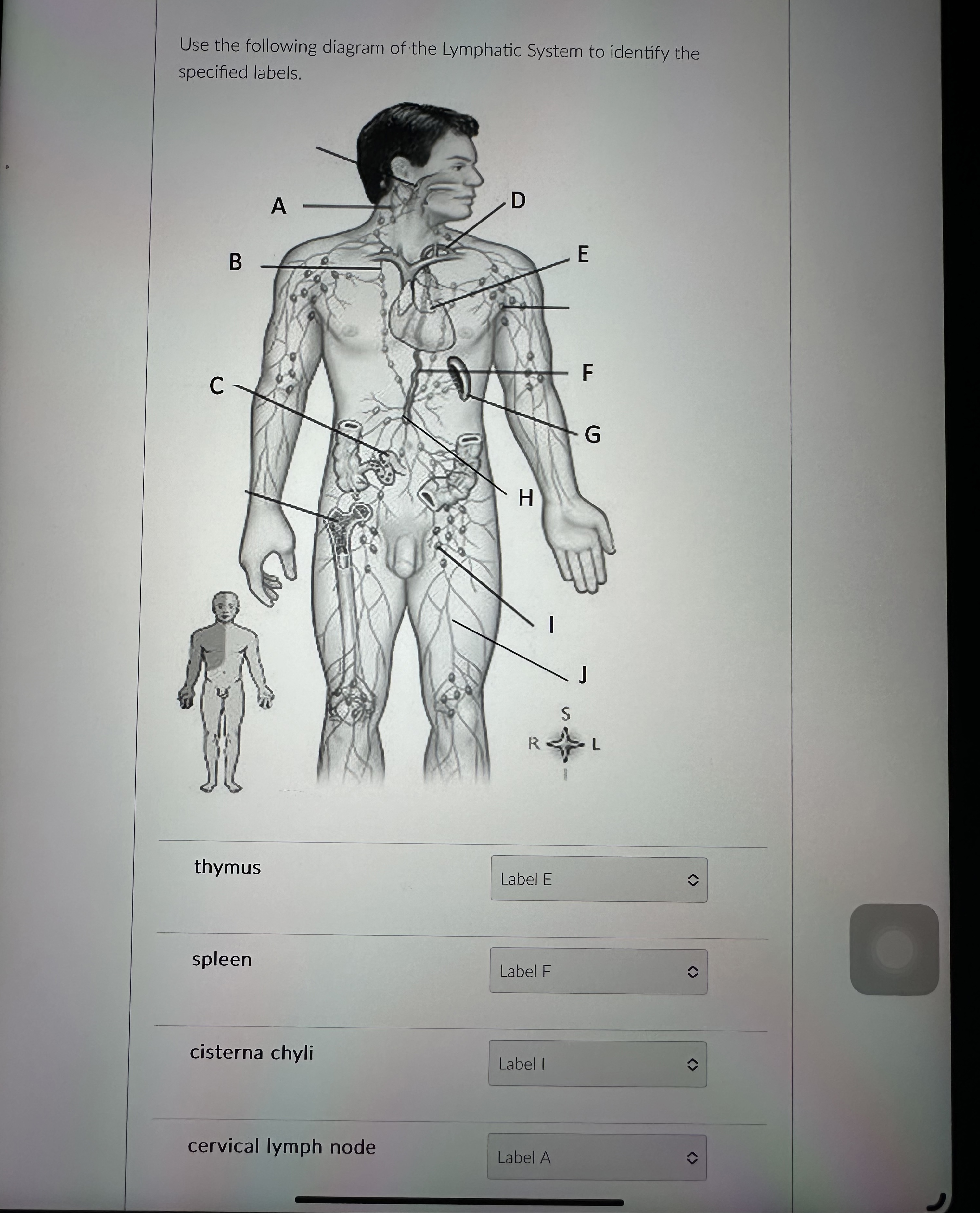 Solved Use the following diagram of the Lymphatic System to | Chegg.com
