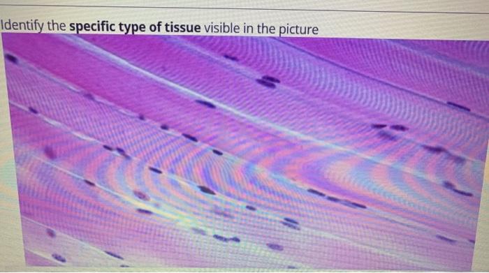 Solved Identify the specific type of tissue visible in the | Chegg.com