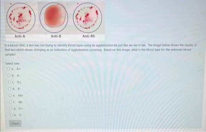 Solved In a blood clinic, a test was run trying to identify | Chegg.com