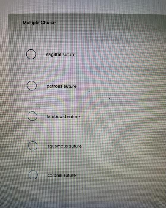 Solved Which structure is highlighted? Multiple Choice | Chegg.com