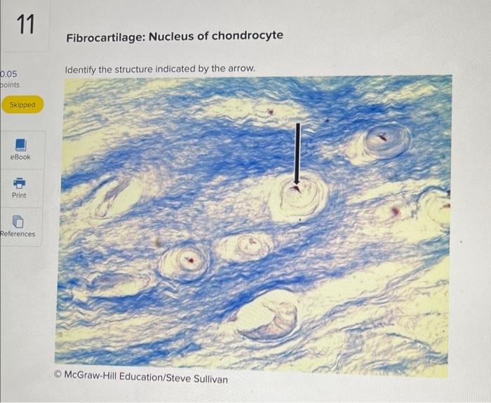 Solved Fibrocartilage: Nucleus of chondrocyte Identifu the | Chegg.com