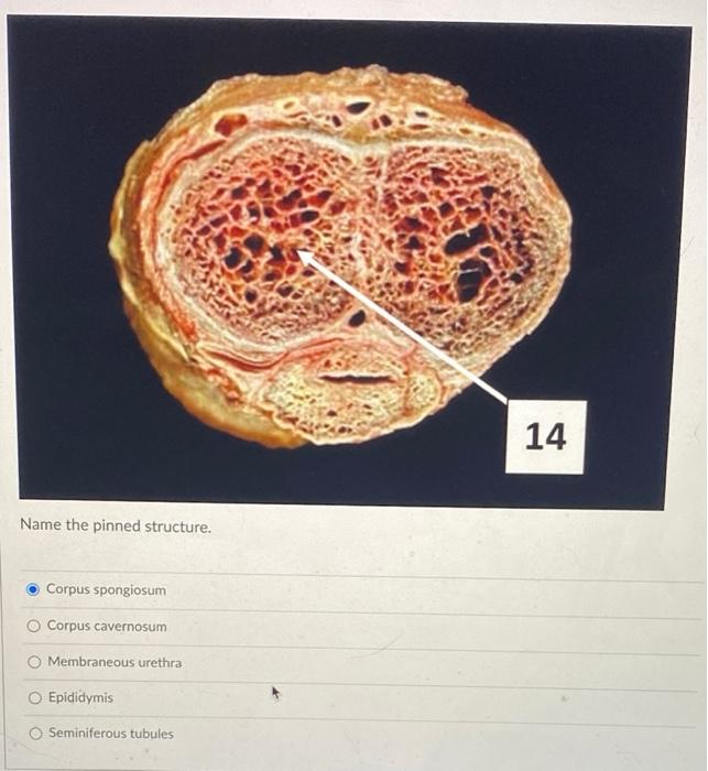 Solved 3 Name the pinned structure. O Left triangular | Chegg.com