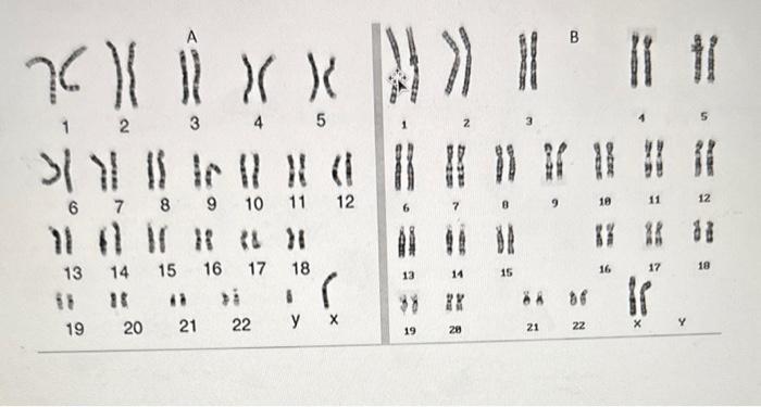 Solved These are karyotypes (pictures of all the chromosomes | Chegg.com