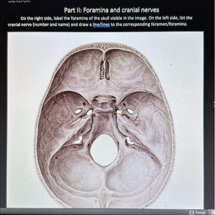 Solved On the right side, label the foramina of the skull | Chegg.com