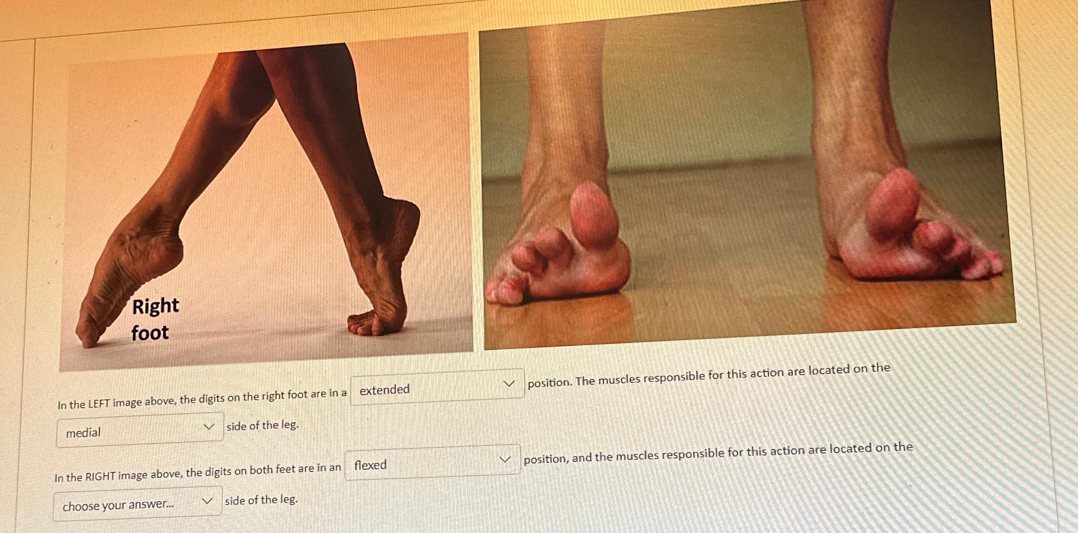 Solved Right footIn the LEFT image above, the digits on the | Chegg.com