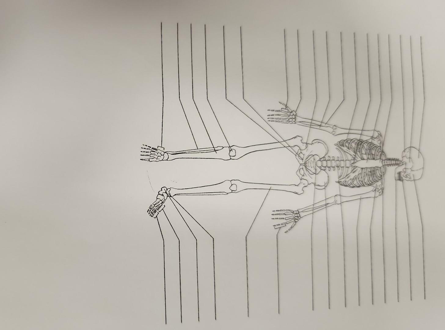 Solved label the skeletal | Chegg.com